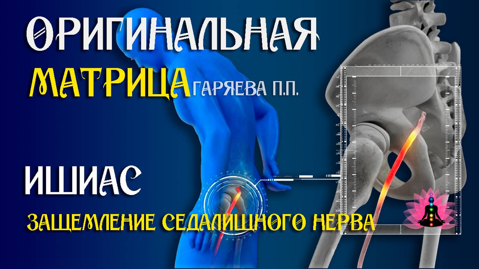 Ишиас » ⚠️ Оригинальная программа матрица по технологии Гаряева ☀️ SoftRadio.ru