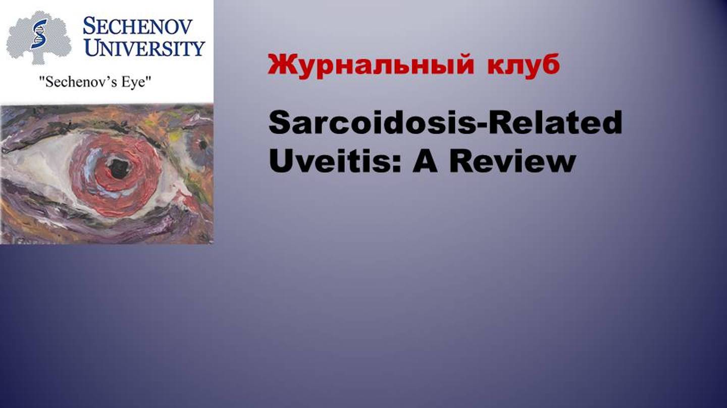 жк саркоидозный увеит