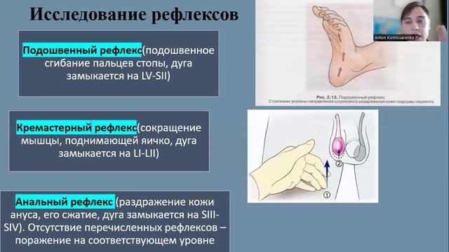 Нарушения движений (парезы и параличи). Неврология.
