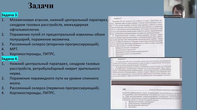 Рассеянный склероз. Острый рассеянный энцефаломиелит