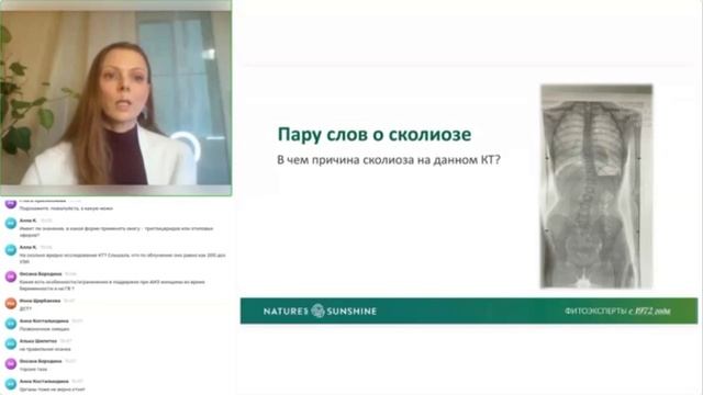 Дегенеративные изменения суставов и позвоночника. Шагинян Ольга