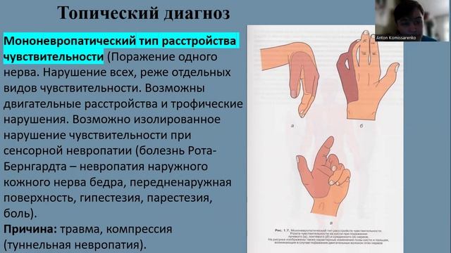 Соматическая чувствительность, нарушения, неврология