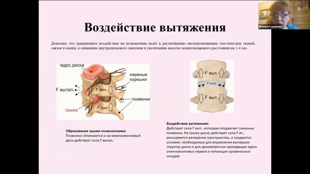 Гурьянова Евгения Аркадьевна, "Реабилитация больных с дискогенной болью с помощью механотерапии"