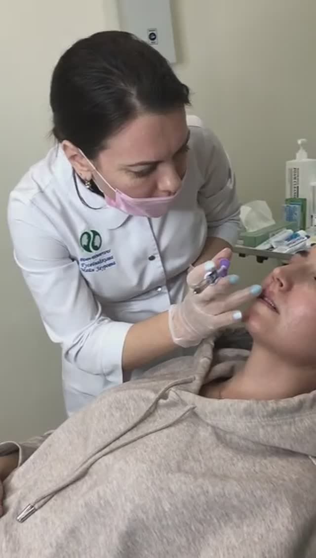 Контурная пластика губ гиалуроновой кислотой