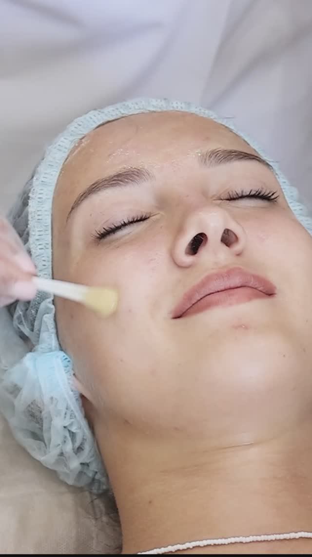 Косметическая чистка лица