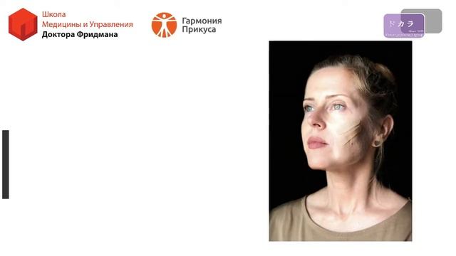 Онлайн-курс Стоматологическое тейпирование. Часть1