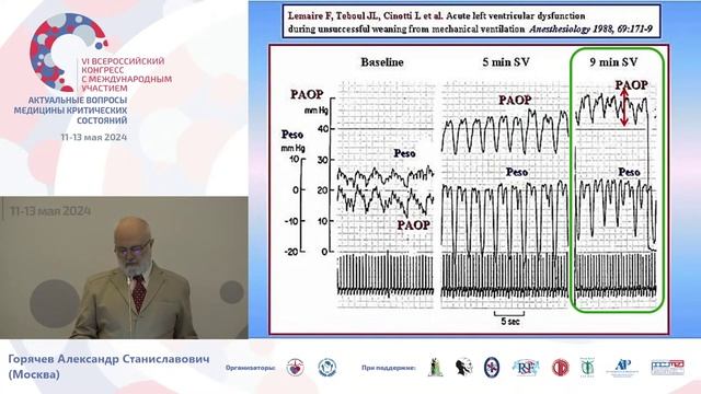 Кардио-респираторное взаимодействие пациента на ИВЛ Горячев А.С. 2024