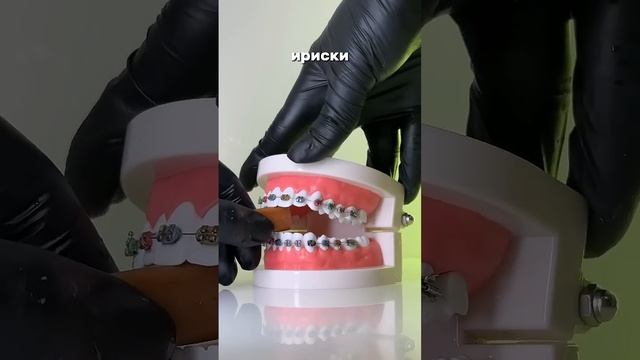 Ни в коем случае не ешь это! Если у тебя стоят брекеты  #зубы #стоматология