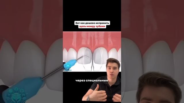 Вот как можно бюджетно исправить щель между зубами