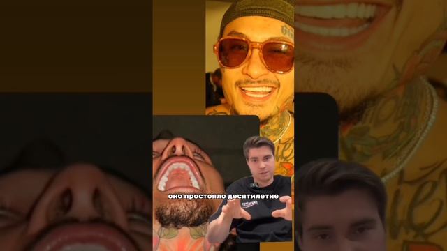 Вы удивитесь какую татуировку звезды делают на зубы