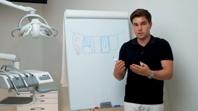 Что такое ВИНИРЫ, насколько они практичны и кому подходят ?