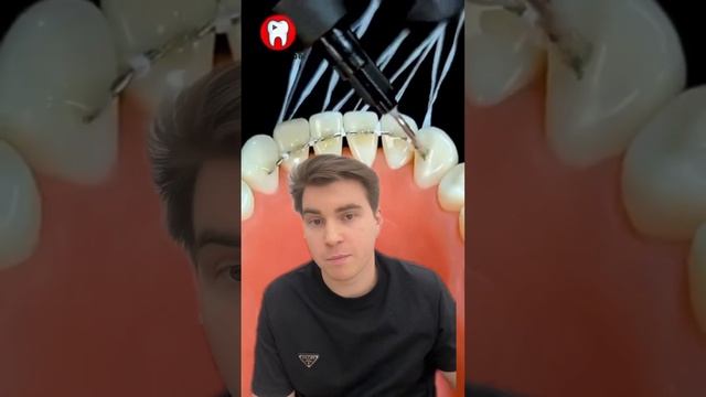 Вот что будет с вами после снятия  брекетов и сколько это продлится