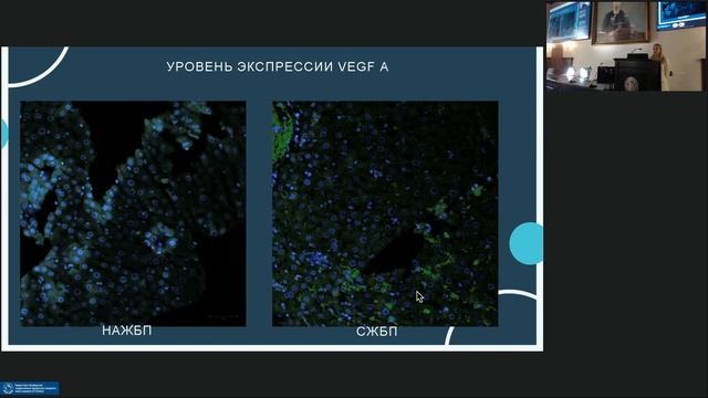 527 заседание Санкт Петербургского общества патофизиологов