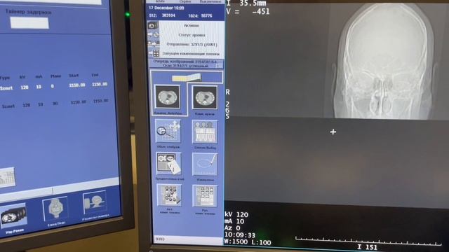 КТ височных костей
Обучение 
Кт оборудования GE OPTIMA