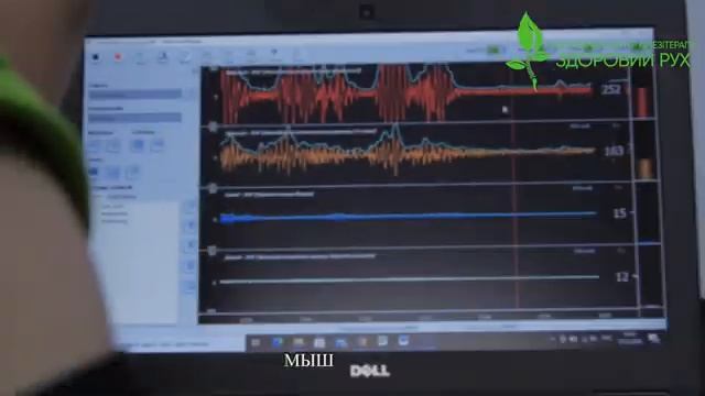 Боль внизу поясницы Это крестцово-подвздошный сустав