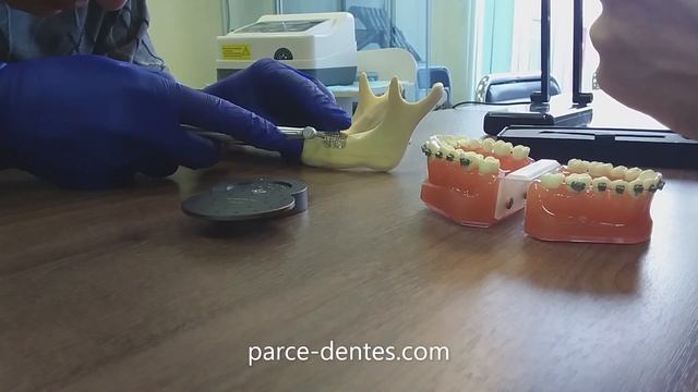 Фиксация мембраны безударными пинами.