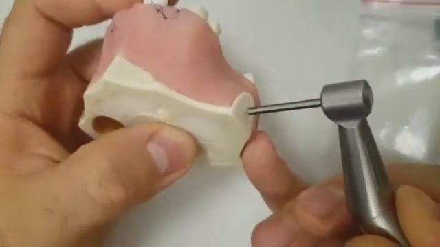 Безударные пины для фиксации мембран