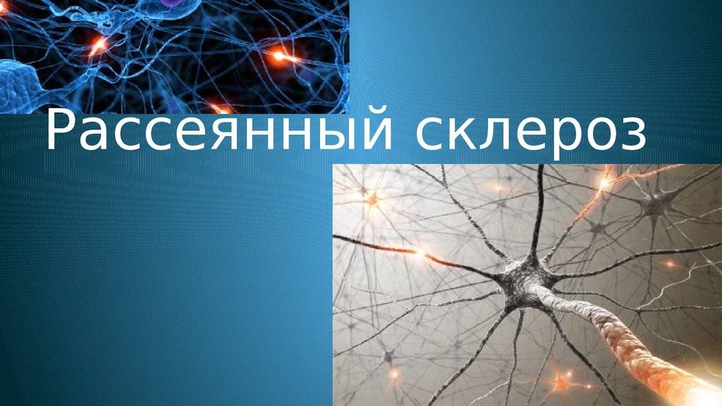 Сказки для взрослых: Рассеянный склероз 2.