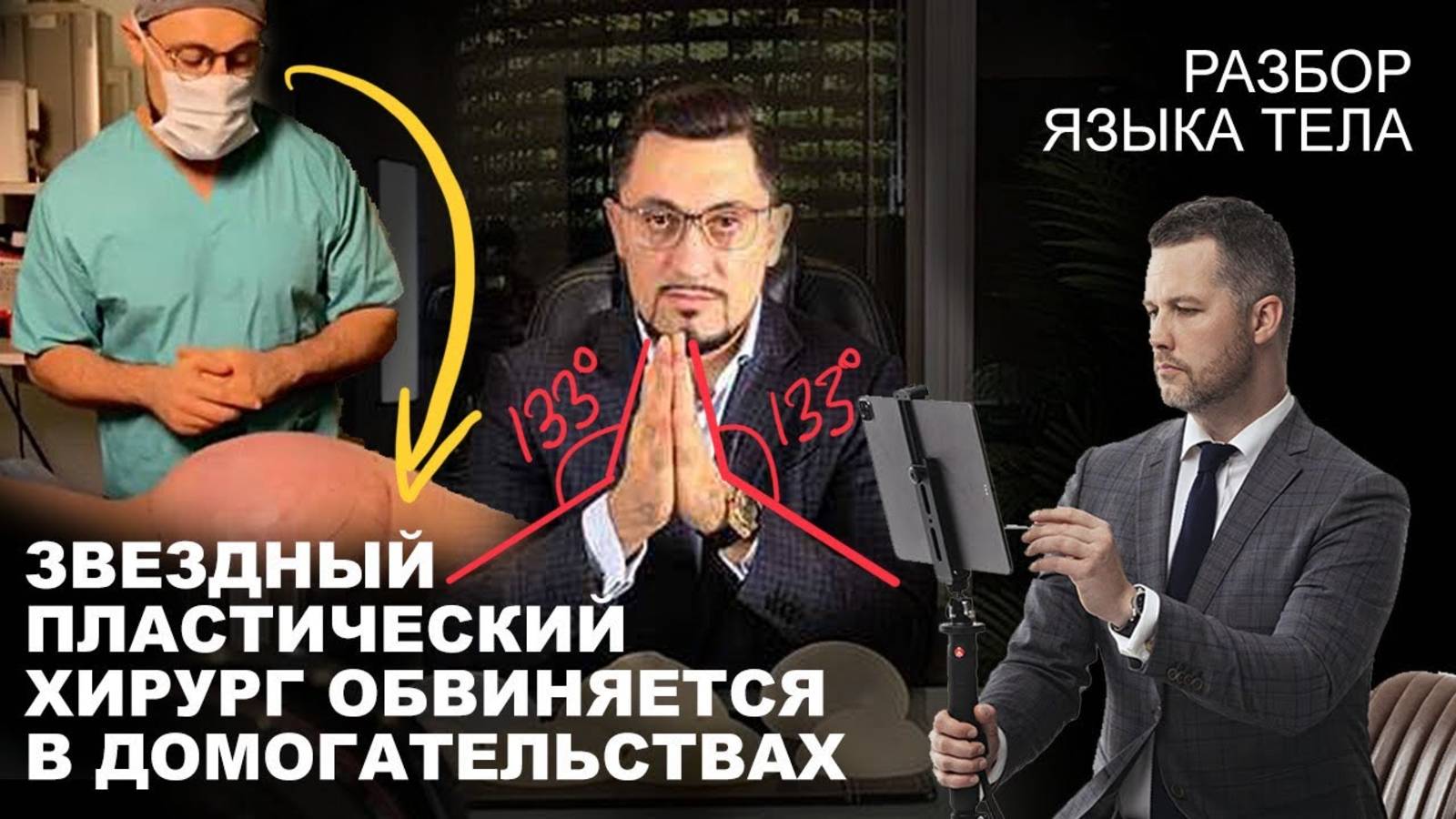 Пластический хирург Вардан Хачатрян. Были ли домогательства? Разбор языка тела.