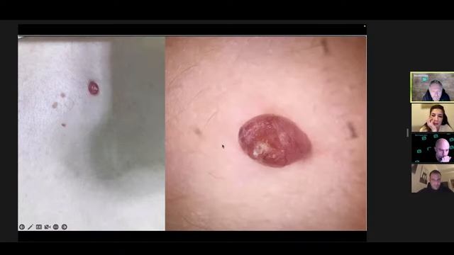 12. Dermoscopy Happy Hour - SEASON 2 EPISODE 12  CASES FROM THE AUDIE pt.2