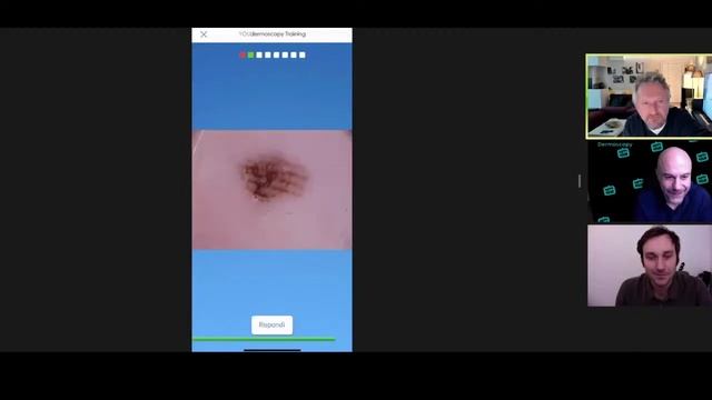 Ep.16 BASAL CELL CARCINOMA with Cristian Navarrete Dechent - Dermoscopy Happy Hour