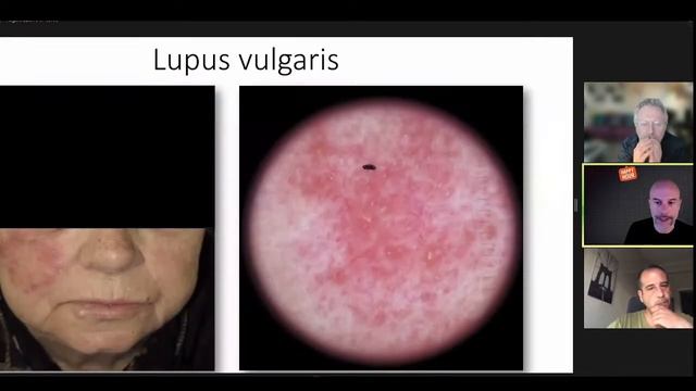 16. Dermoscopy Happy Hour - RED FACE! - SEASON 3 Ep16