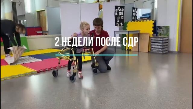 СДР – две недели после операции