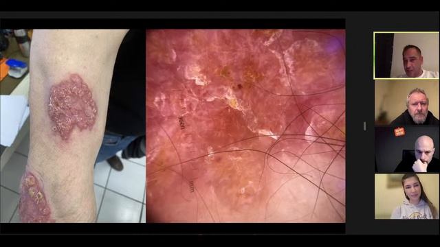 10. Dermoscopy Happy Hour! SMALL ANIMALS! SEASON 3 Ep10