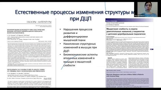 Методы лечения спастичности при церебральном параличе