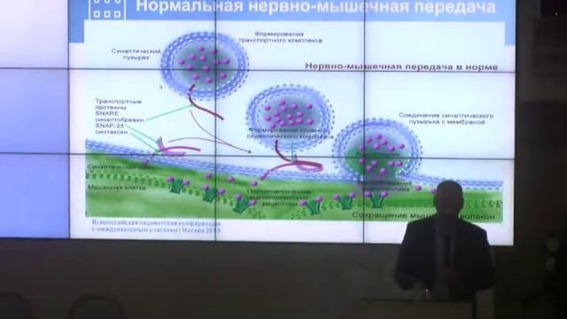 Что такое спастичность и как с ней бороться при ДЦП. Роль ботулинотерапии в лечении ДЦП