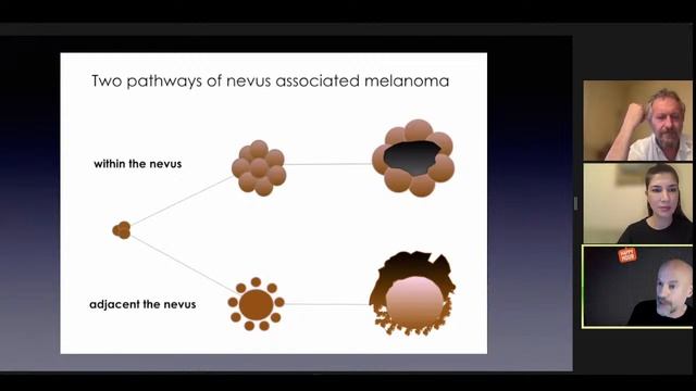 12. Dermoscopy Happy Hour - MYTHS RELATED TO SKIN CANCER! - SEASON 3 Ep12