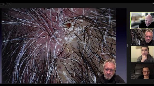 08. Dermoscopy Happy Hour! - TRICHOSCOPY - SEASON 3 Ep8