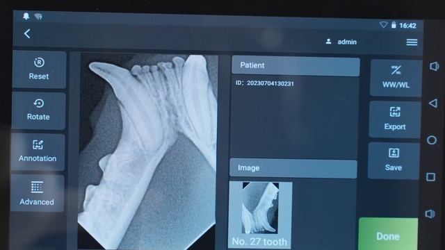 Портативный дентальный рентген Canis Smart2