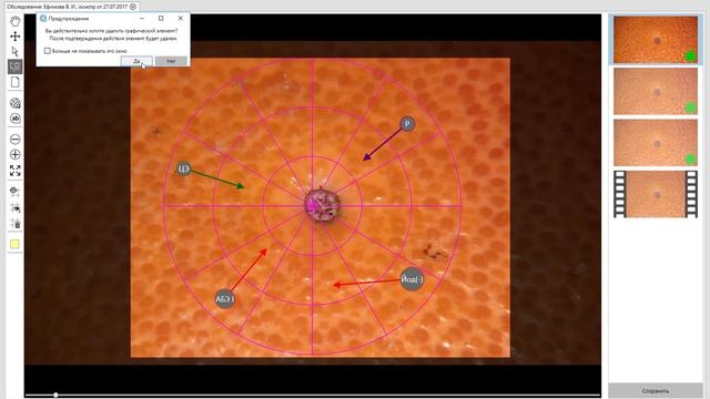 ColpoZoom. Часть 5. Протокол