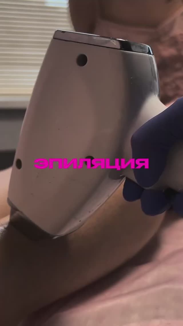 Лазерная эпиляция