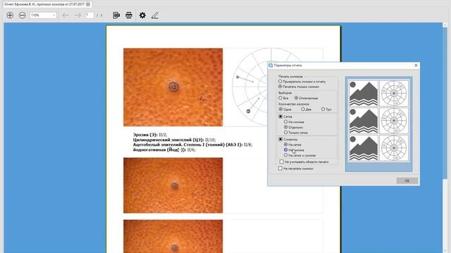 ColpoZoom. Часть 6. Отчет