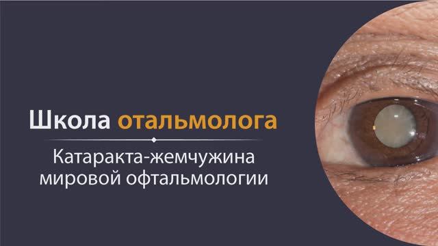 Школа офтальмолога. Катаракта-жемчужина мировой офтальмологии