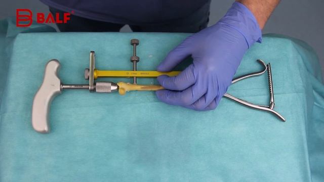 Установка блокируемого штифта BALF® | диаметр 3,5 мм | сухая кость