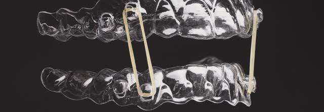 Графическое видео для конференции про элайнеры Eurokappa/Портфолио SOLO PRO