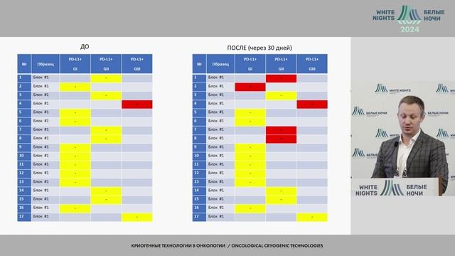 Криоаблация опухолей почки. Клинические и иммунологические аспекты проблемы / #WNOF2024