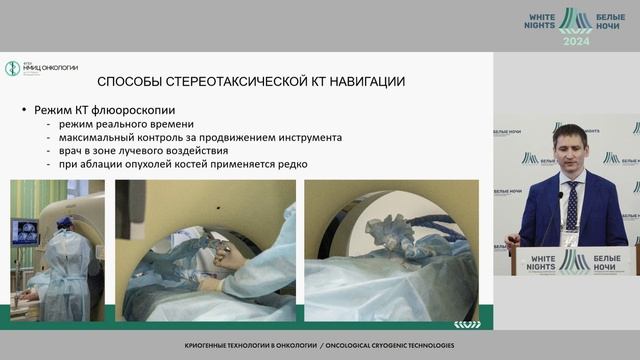 Возможности лучевых методов диагностики в планировании, навигации и мониторинге криоаблации опухолей