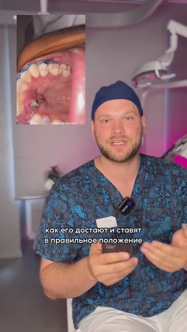 Зуб прорезался небно! Удалять или можно выровнять?