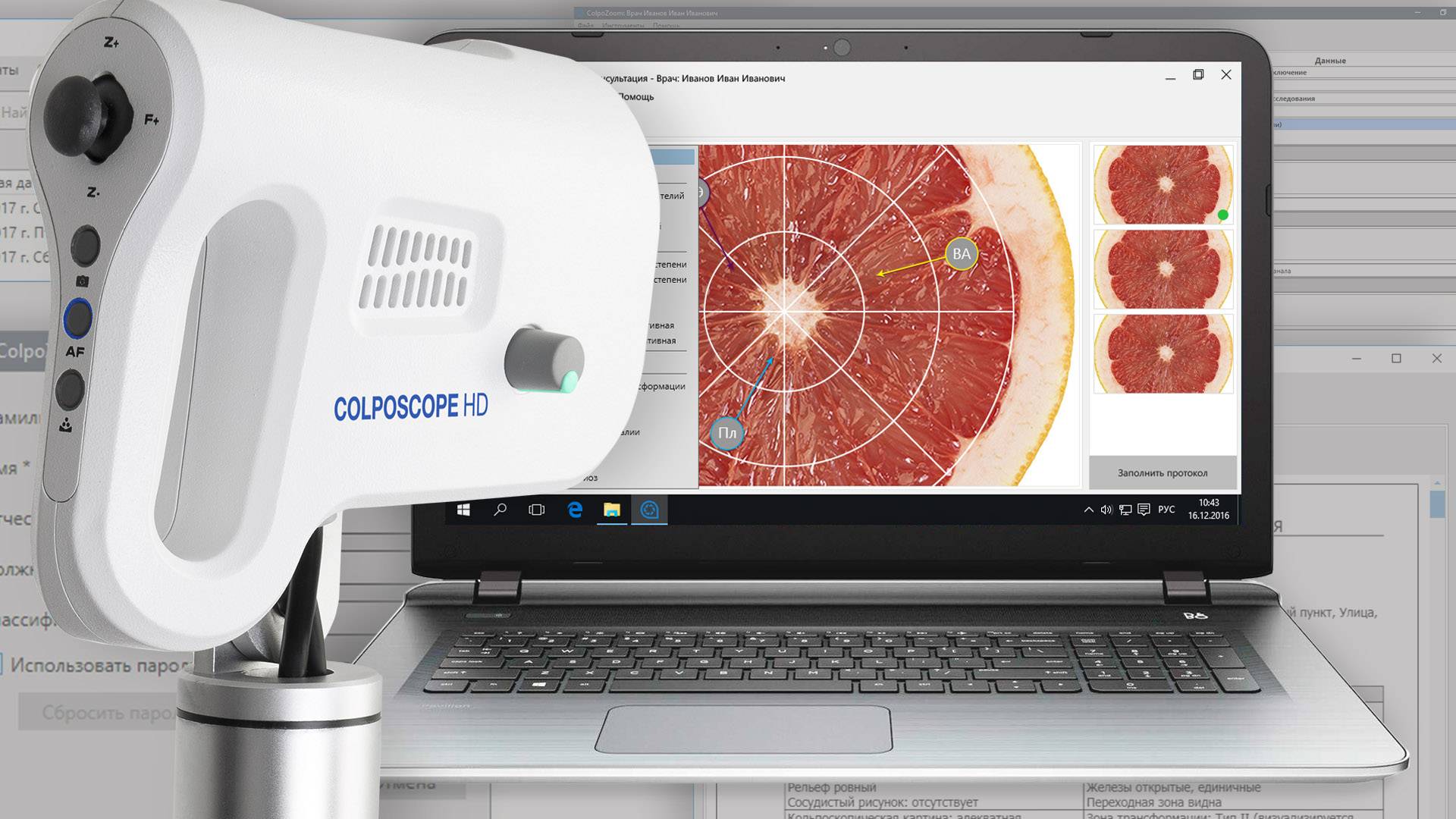 ColpoZoom. Часть 1. Главное окно программы