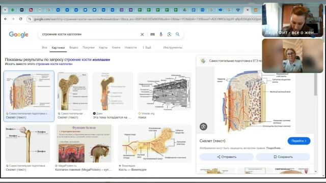 ПОЧЕМУ БОЛИТ СПИНА.  Отвечает инструктор ЛФК
