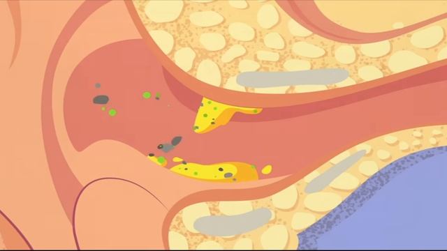 Что такое ушная сера — и следует ли от нее избавляться?