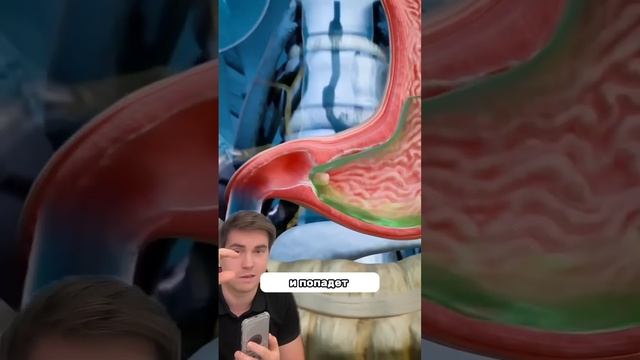 Вот что будет,если вы проглотите зуб #зубы #стоматология #доктор