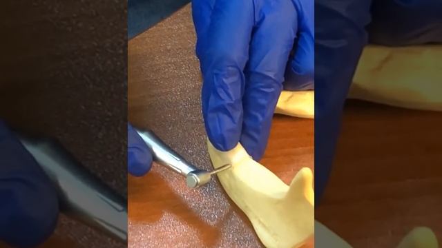 Безударный способ фиксации мембран