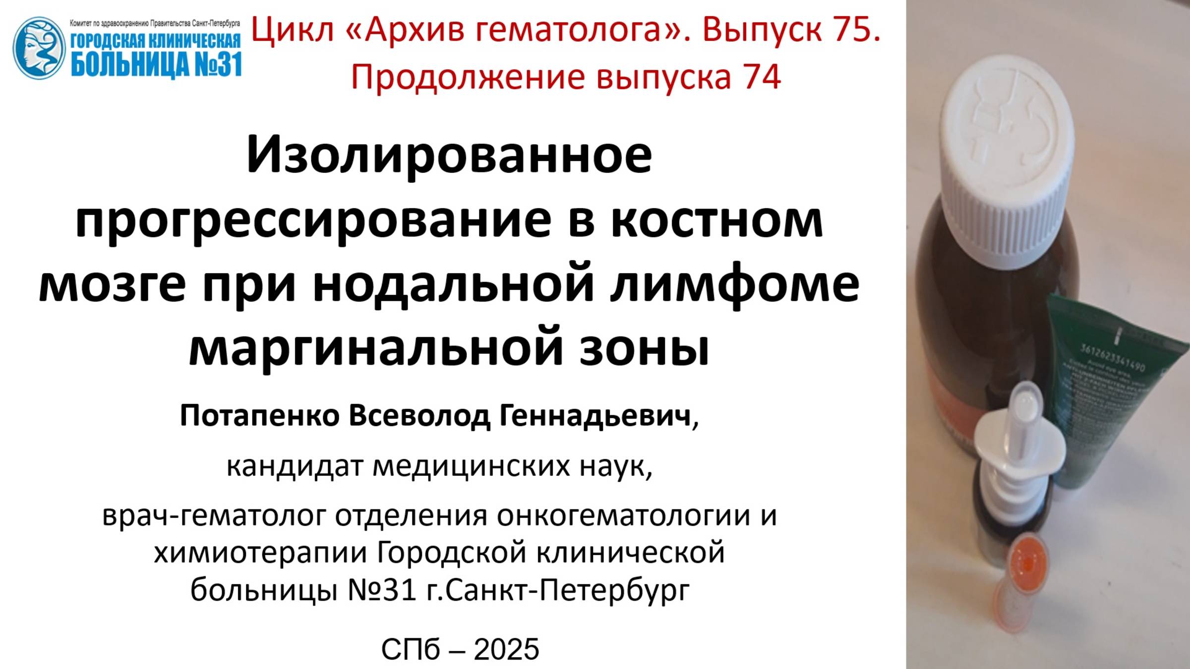 Архив гематолога 75. Изолированная костномозговая прогрессия нодальной лимфомы маргинальной зоны