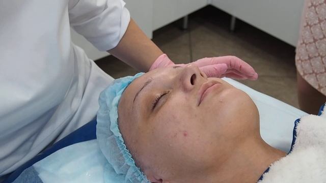 Мезопилинг фракционно и мануально (Часть 1)