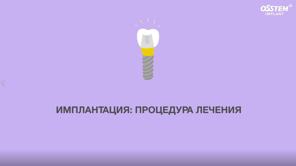 Имплантация: процедура лечения
